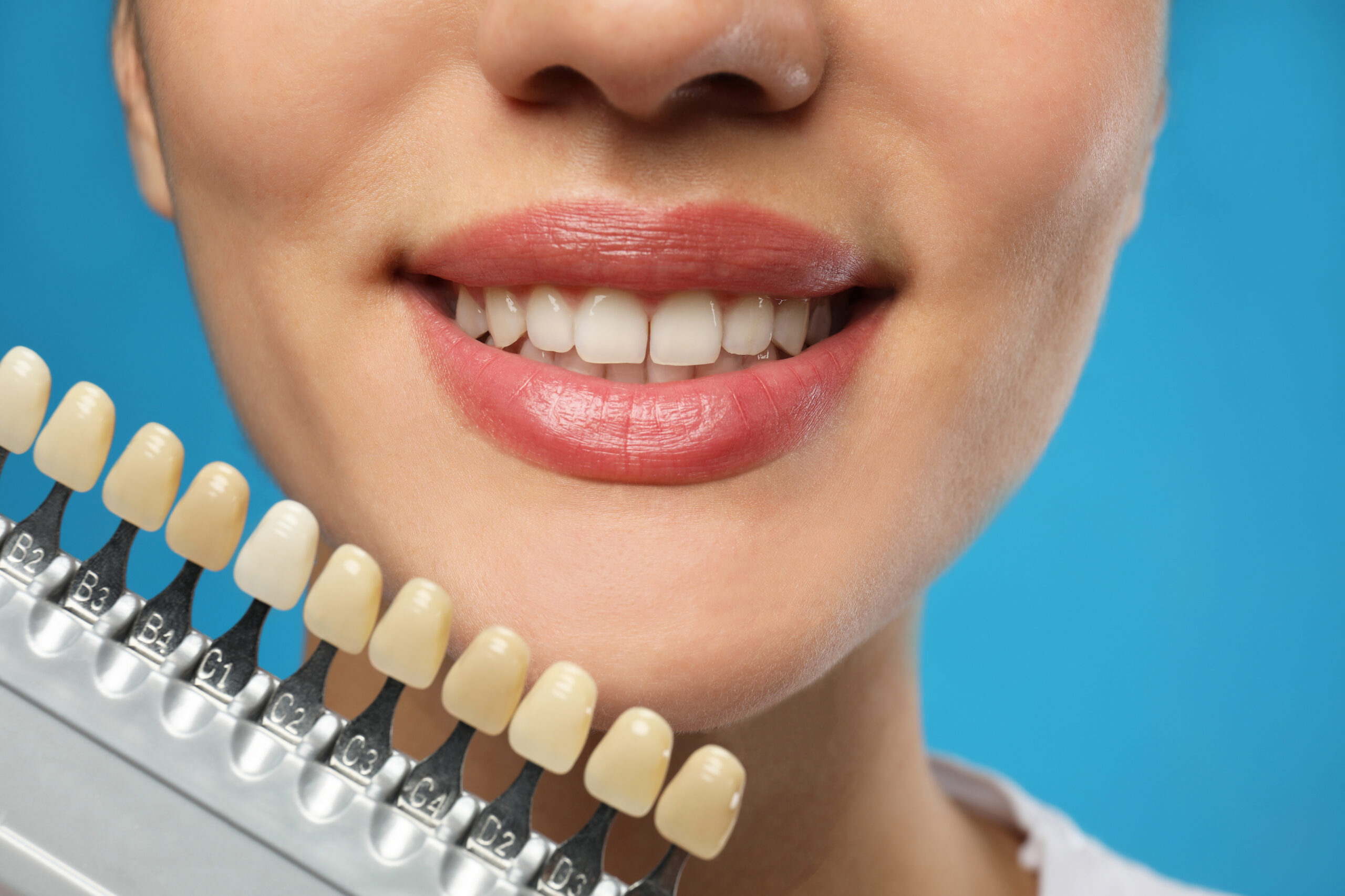 Teeth Whitening Treatment in Grand Rapids - Greenland Advanced Oral Care